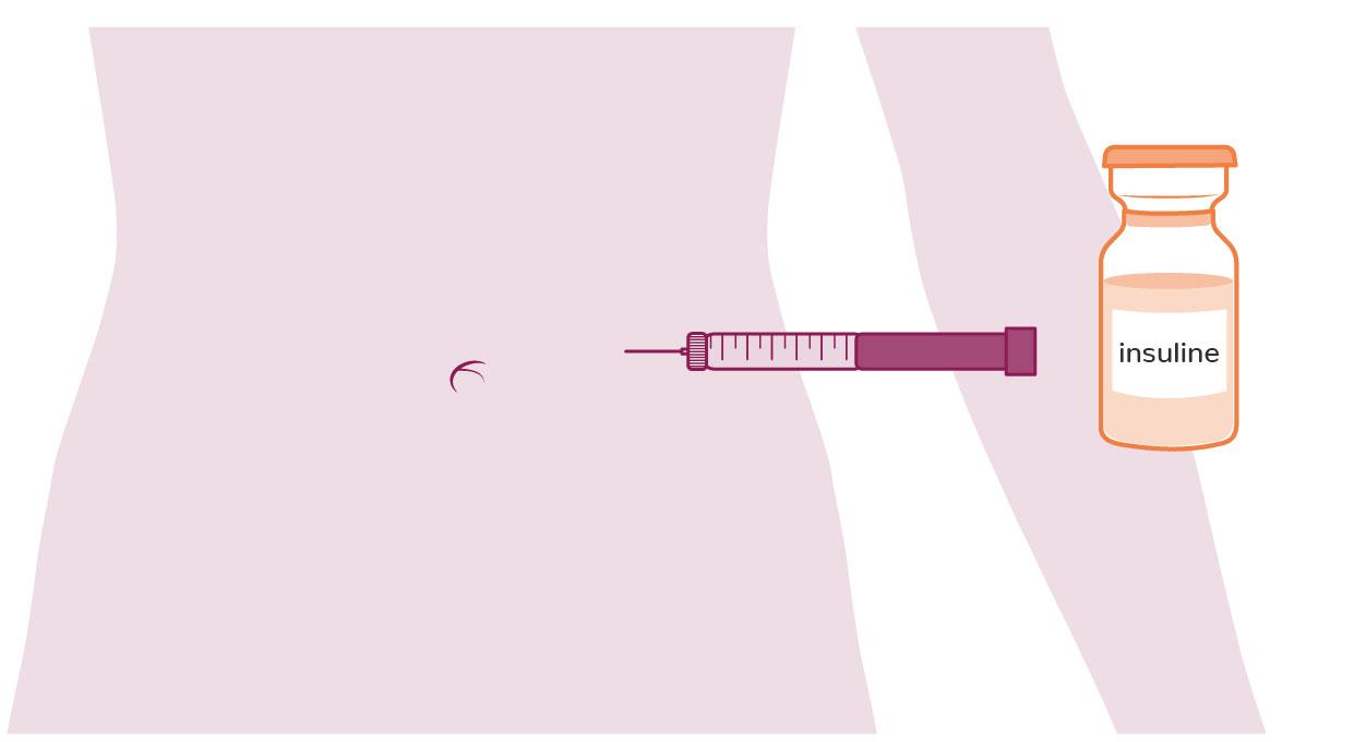 Insuline spuiten bij diabetes type 2 - diabetes.nl